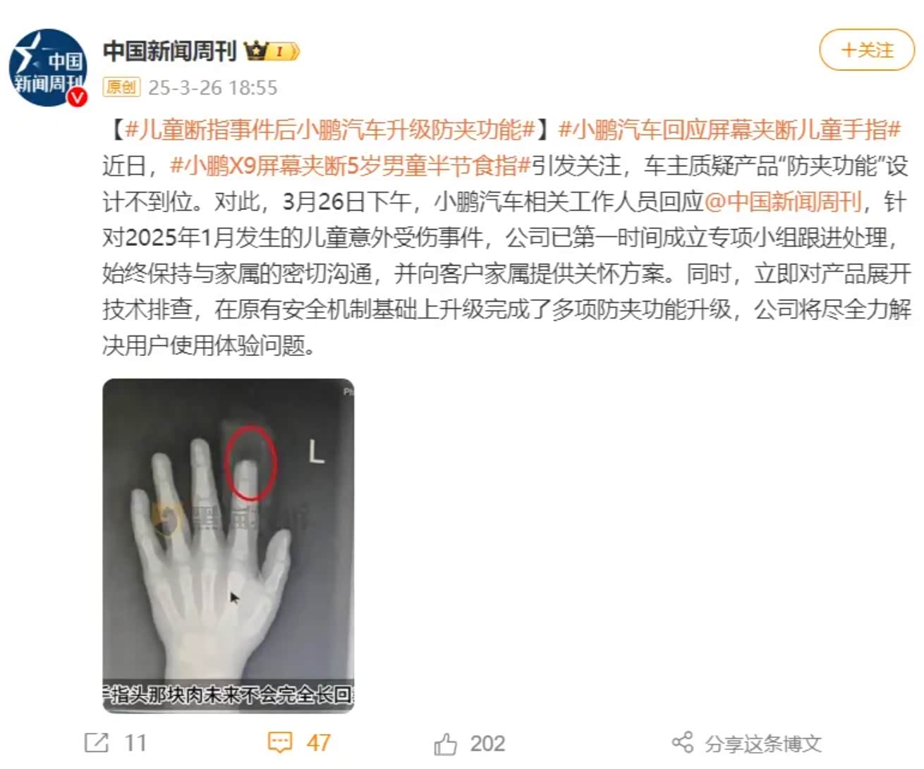 【文章】【理想高管称想MEGA、L9、L7、L8二排屏幕，均有“防夹”功能】日前在小鹏X9曝出屏幕夹手风波后，理想汽车制造工程负责人“造个理想的徐爸”及产品线负责人“老汤哥Tango”在社交 ...